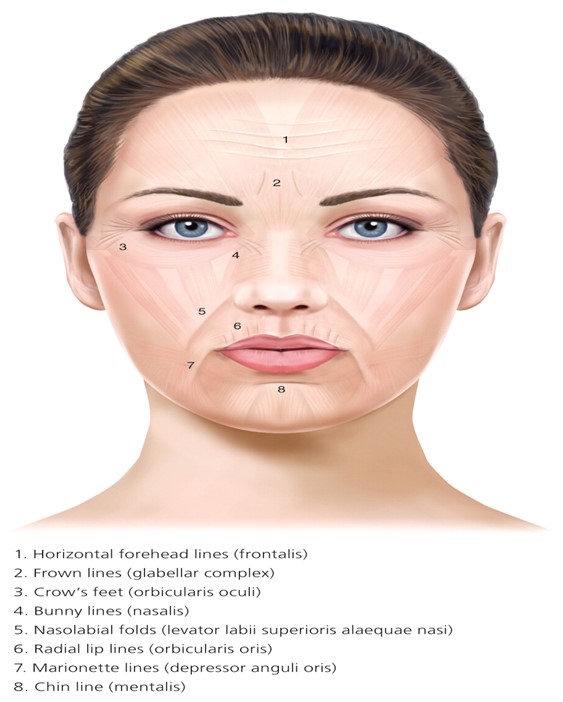 Botox for Face Wrinkles - Saran Skin Clinic